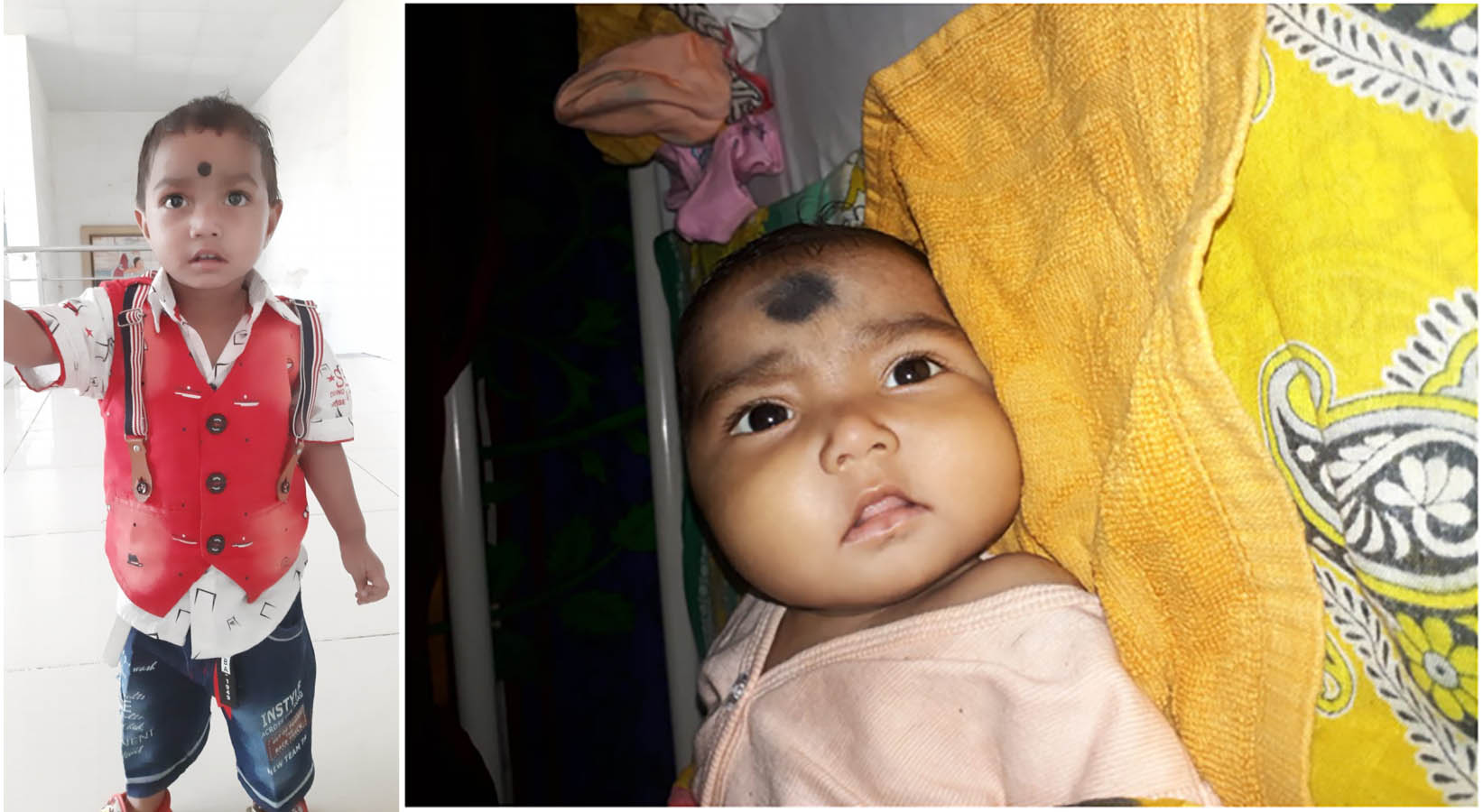 A rewarding experience in a child with FTT(failure to thrive) at KIMS ...